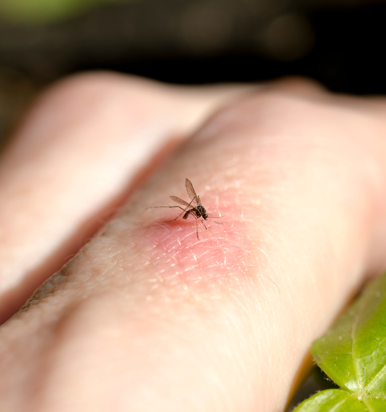 Insect Bites - Health Express Clinics