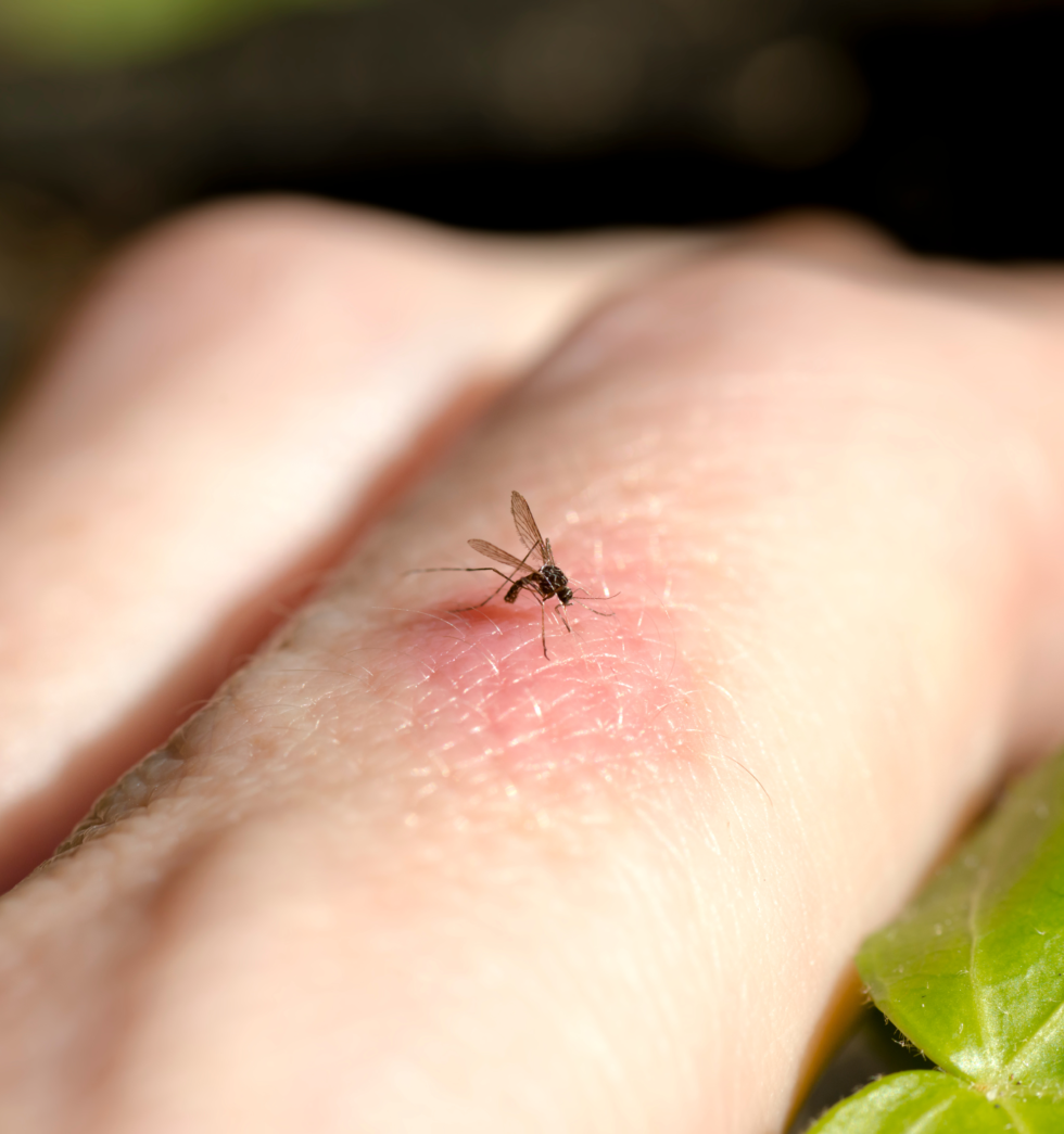 Insect Bites - Health Express Clinics